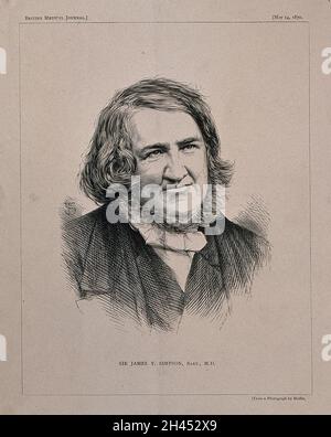 James Simpson. Engraving of Sir James Young Simpson (1811-70), the ...