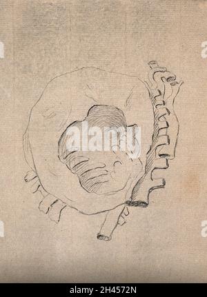 A diseased part of the body. Drawing Stock Photo - Alamy