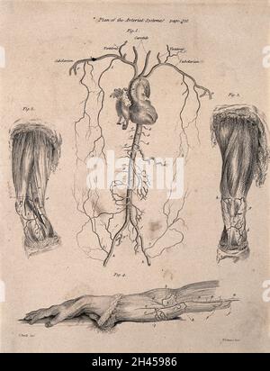 Dissected human heart Stock Photo - Alamy