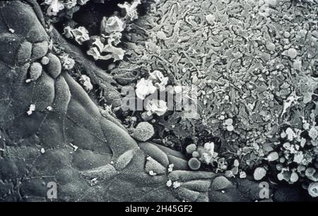 embryo wound healing SEM Stock Photo - Alamy