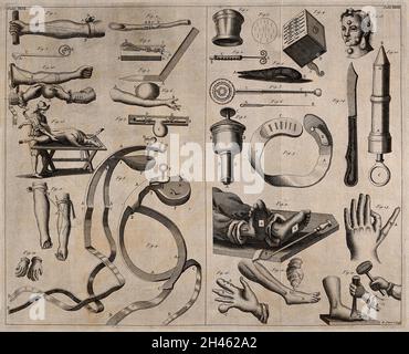Surgical instruments. Engraving with etching by R. Parr Stock Photo - Alamy