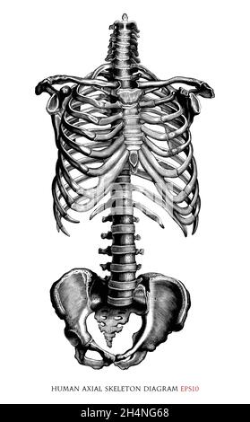 vector illustration of skeleton of the lower limbs in rickets Stock ...