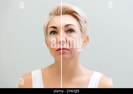 The face of a young girl is divided into two halves with and without ...