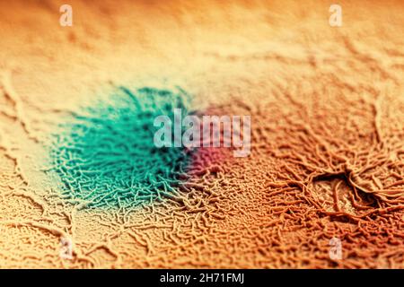 Scanning electron microscope image of a breast cancer cell Stock Photo ...