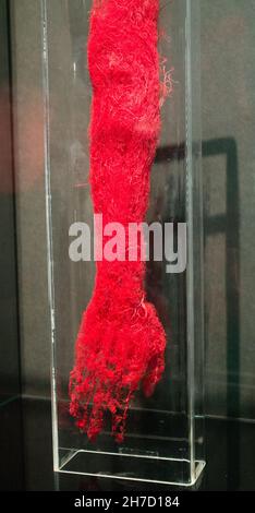 Vertical shot of veins in the arm anatomy Stock Photo - Alamy