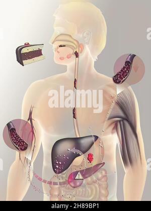 Human pancreas with diabetes Mellitus type 1 showing acin, and islets ...