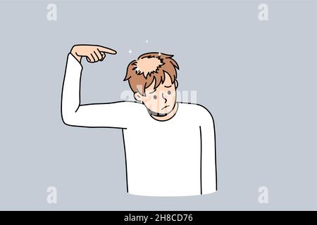 cartoon stressed bald man Stock Vector Image & Art - Alamy