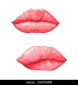 Angioedema or edema of lips, allergic swelling of lower layer of face ...
