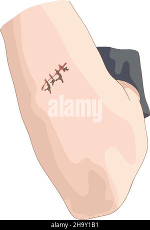 The Scar. Vector illustration Stock Vector Image & Art - Alamy