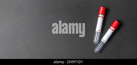 Background of the PCR tubes PCR Tubes on black background Stock Photo ...