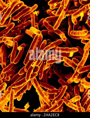 Mycobacterium tuberculosis Bacteria, the Cause of TB Scanning electron micrograph of ...