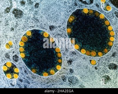 transmission electron microscope image of yellow fever virus Stock ...