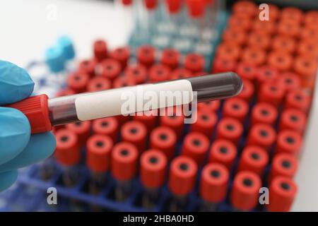 A test tube with a blood sample with empty label in the doctor's hand ...
