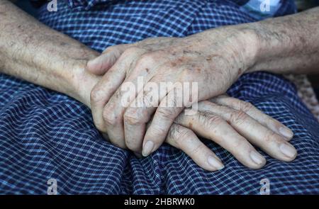 Age spots on the forearm and the hand of a 72-year-old woman Stock ...
