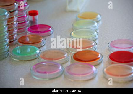 Bacterial colonies of streptococci with alpha hemolytics on a blood ...