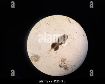 Inferior crustacean under the microscope magnification Stock Photo - Alamy