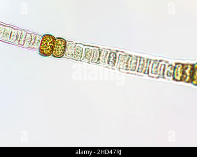 Nodularia algae under microscopic view, nitrogen-fixing cyanobacteria ...