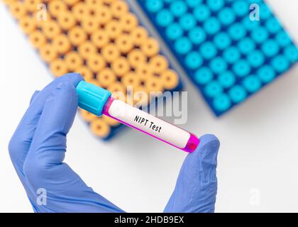 NIPT or Non Invasive Prenatal Testing, diagnosis for fetal Down ...