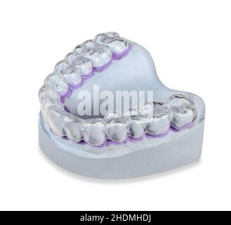 Plaster impressions of the teeth of the lower a jaw for prosthetics and ...