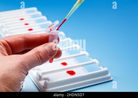 research, laboratory, blood sample, researchs, laboratories, blood ...