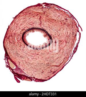 cross section, anatomy, ductus deferens, cross sections, anatomies ...