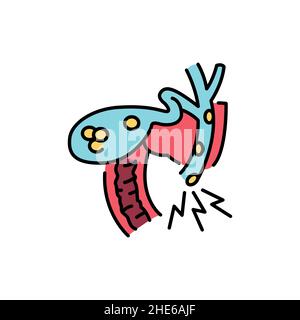 Chronic cholecystitis color line icon. Human diseases. Pictogram for ...