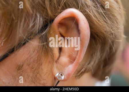 Bleeding from the ear Stock Photo - Alamy