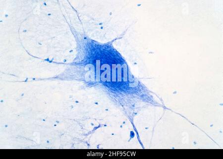 Light micrograph of human brain tissue showing neurons and glial cells ...