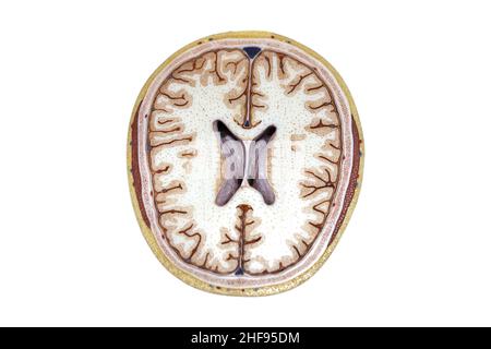Transverse-section illustration of the human brain Stock Photo - Alamy