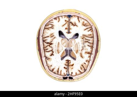 Transverse-section illustration of the human brain Stock Photo - Alamy