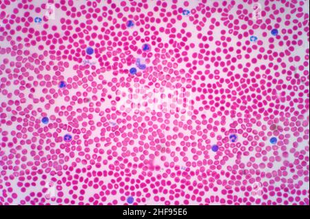 Blood cells. Light micrograph of red blood cells (erythrocytes, light ...