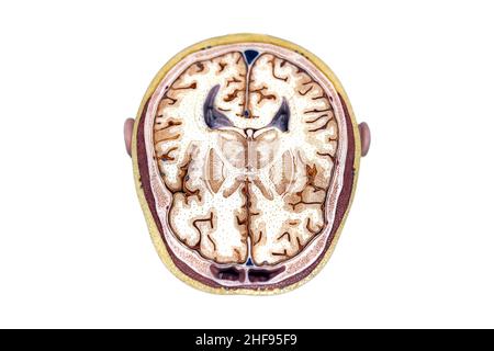 Transverse-section illustration of the human brain Stock Photo - Alamy