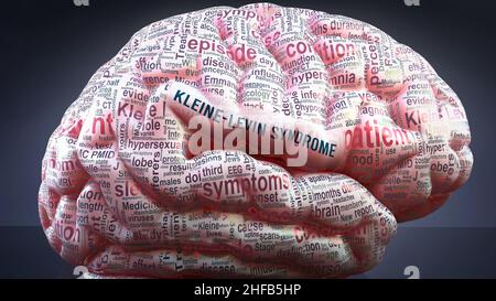 Kleine levin syndrome anatomy - its causes and effects projected on a ...