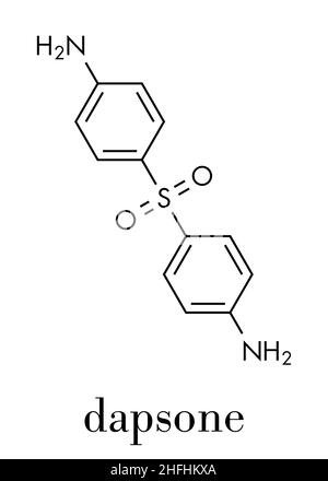 Dapsone antibacterial drug molecule. Skeletal formula Stock Vector ...