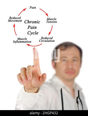 Steps in Chronic Pain Cycle Stock Photo - Alamy
