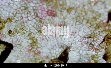 Potato under the microscope Stock Photo - Alamy