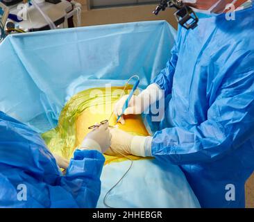 Side view of three surgeons at work in the operating theatre Stock ...