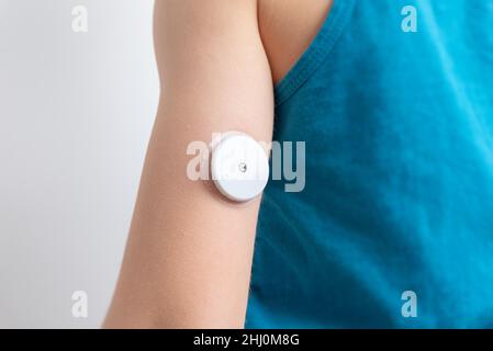 Blood glucose sensor on the arm of a child. Sensor for remote ...
