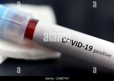 beaker with coronavirus blood test at laboratory Stock Photo - Alamy