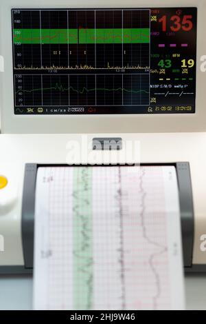 Electronic Fetal Monitoring, cardiotocography in hospital maternity ...