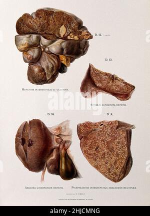Human liver. Illustration of the 19th century. Germany. White ...