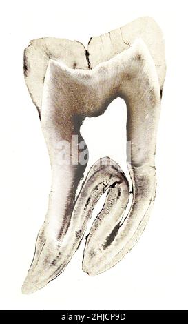 Vertical section of human tooth. Magnification: 8x. Photomicrograph ...
