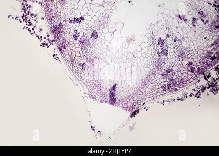 Peronospera transverse section on a host as viewed through a light ...