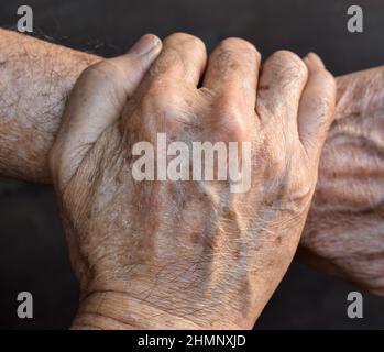 Age spots on the forearm and the hand of a 72-year-old woman Stock ...
