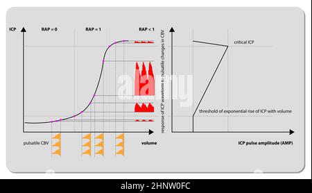 Intracranial Pressure Monitoring ICP waveform, 3d render, 2d graphic ...