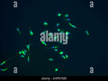 Microglia, shown in green, are part of the immune response that ...