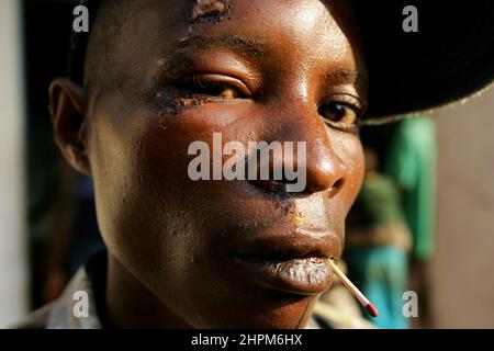 Everyday life in the slums at Lake Kivu near Bukavu Congo. The picture ...