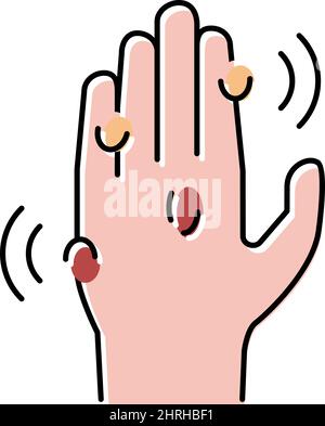 Warts color line icon. Human diseases Stock Vector Image & Art - Alamy