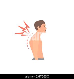Poor posture, illustration Stock Photo - Alamy