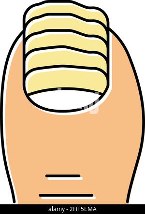 Nail fungus color icon vector logo set collection for web app ui Stock ...